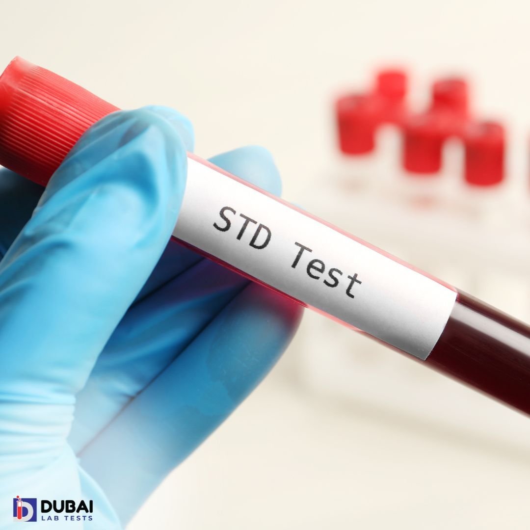 STD 4 Panel STD Test Dubai STD 4 Panel STD Test Dubai